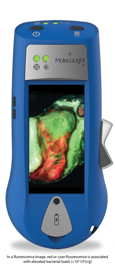 Home Moleculight - MoleculightSA